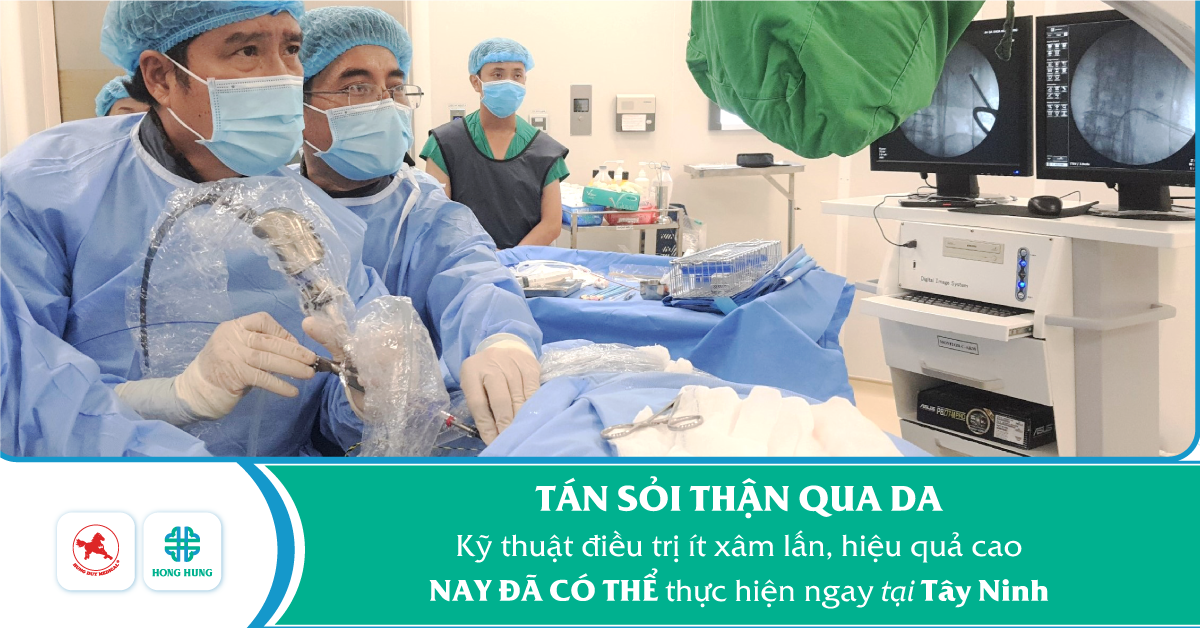 Tán sỏi thận qua da - kỹ thuật điều trị ít xâm lấn, hiệu quả cao – nay ...
