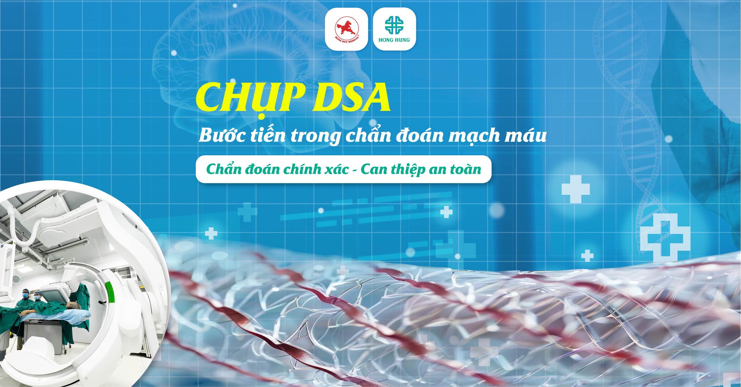 Hệ thống chụp ảnh mạch số hóa xóa nền (DSA) tiên tiến tại BVĐK HỒNG ...
