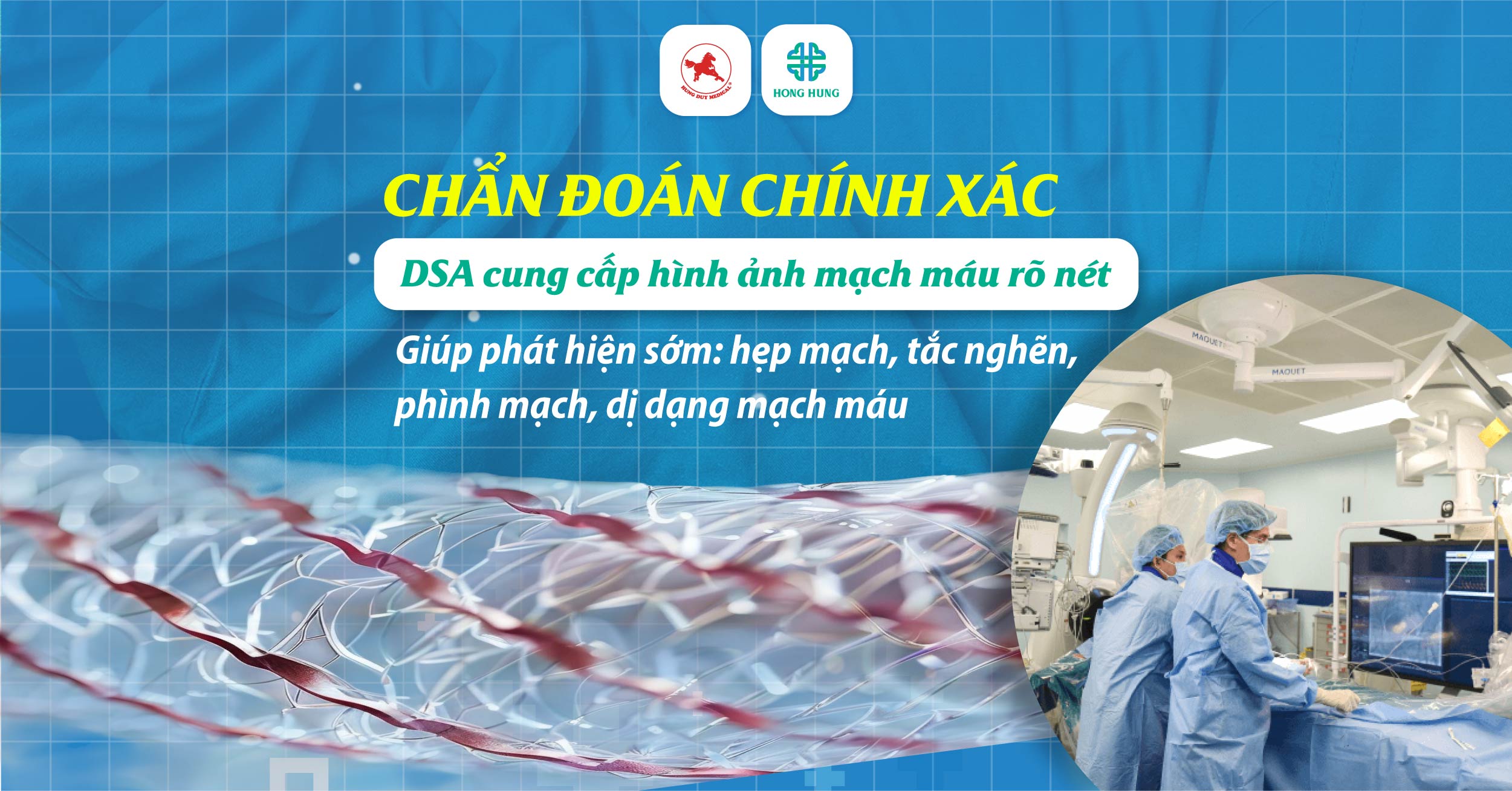 Hệ thống chụp ảnh mạch số hóa xóa nền (DSA) tiên tiến tại BVĐK HỒNG ...